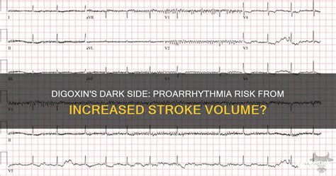 Digoxins Dark Side Proarrhythmia Risk From Increased Stroke Volume Medshun