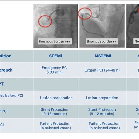 Current Open Issues In Dual Antiplatelet Therapy Download Scientific