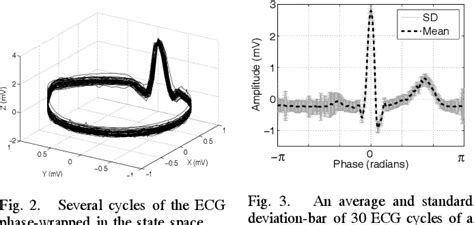 Figure 3 From A Nonlinear Bayesian Filtering Framework For Ecg