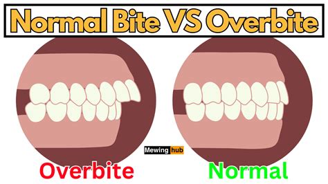 Fwhr How To Measure Calculate And Maximize Facial Ratios Mewinghub