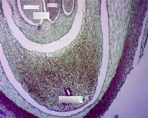 Pine Ovule Fertilization L S Lab 3 G Diagram Quizlet