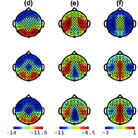 Variation Of Mean Spectral EEG Features Across Resting BL St Row Download Scientific