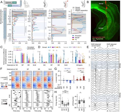 Deep Learning Based Feature Extraction For Prediction And Interpretation Of Sharp Wave Ripples