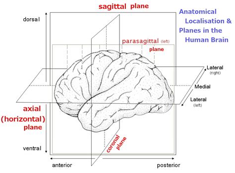 Axial Plane Brain