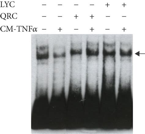 Effect Of Antioxidants On Neuronal Nf κb Binding Activity Ad Emsa Download Scientific