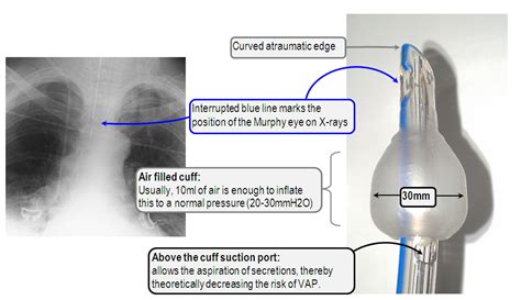 The Endotracheal Tube In Detail Deranged Physiology