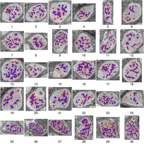 Voronoi Tessellation Over Fibril Locations With Voronoi Cells Coloured