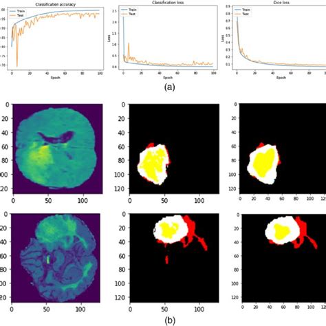 A Evaluation Graphs For Detection And Segmentation B Input Mri