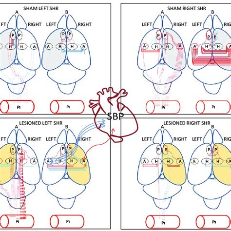 Total Number Of Intra Intra Left Or Intra Right And Inter Hemispheric