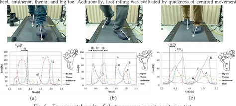 Figure 5 From Monitoring Of Plantar Pressure In Gait Based On Hetero Core Optical Fiber Sensor