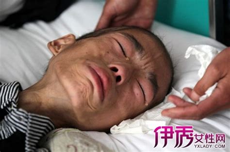 癌症怕吃什么食物图癌症怕吃什么食物 4种食物是癌症的导火索 3 伊秀健康 yxlady