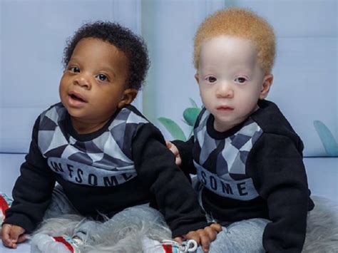 Albino Twins