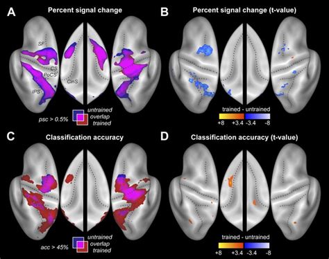 Figures And Data In Skill Learning Strengthens Cortical Representations Of Motor Sequences ELife