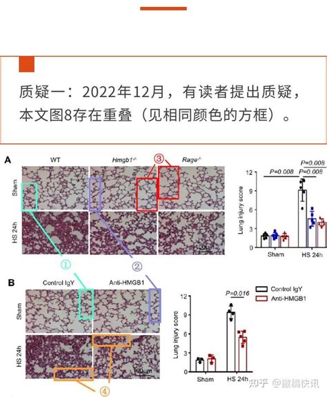 作者已致歉浙江大学附属第一医院的一区论文因图片误用受质疑 知乎
