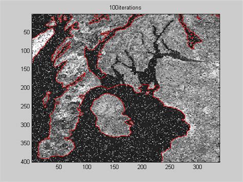 Shows The Results Of A Input Image With Noise B Initial Contour C