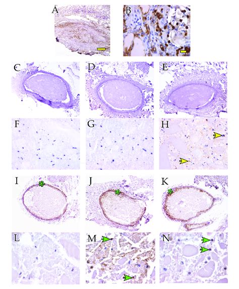 Macrophage Mediated Inflammatory Response After Ectopic Hydrogel Download Scientific Diagram