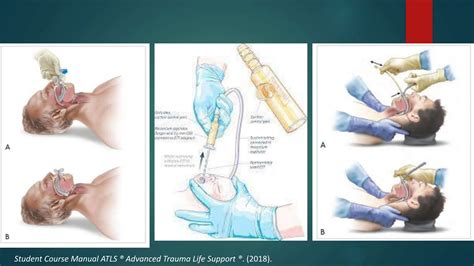 Atls Protocolpptx First Aid Injuries