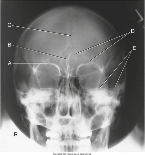 Skull Hw Flashcards Quizlet