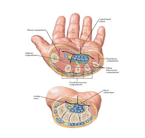 Section Through Metacarpal And Distal Carpal Bones Anatomy Pediagenosis