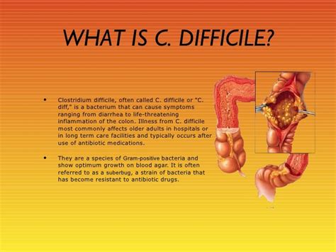Clostridium Difficile