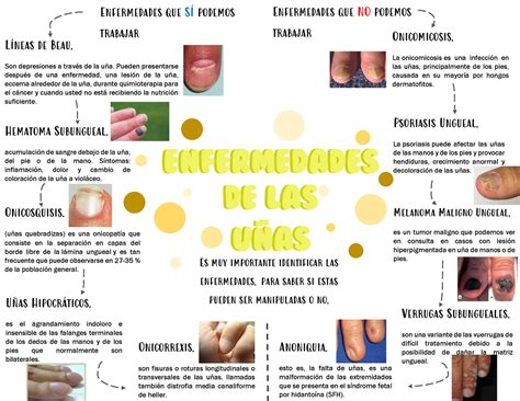Enfermedades De Las Uñas Enfermedades De Las Unas Enfermedades De Las