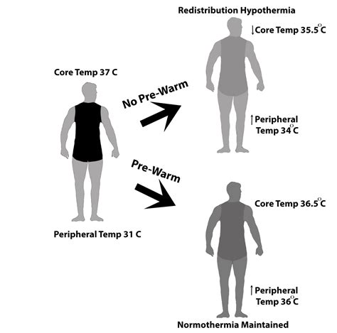 Prevent Perioperative Hypothermia Retain Heat The Airway Jedi