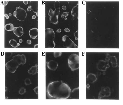 Figure 1 From Antitumor Activity Of Mannan Binding Protein In Vivo As