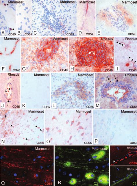 Complement Regulatory Proteins CD35 CD59 CD46 And CD55 Are Download Scientific Diagram