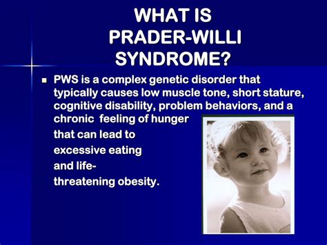 Ppt Living With Prader Willi Syndrome Powerpoint Presentation Free Download Id 5202701
