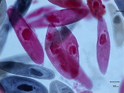 Protists Fungi Flashcards Quizlet