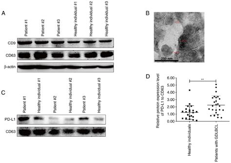 Differential Protein Expression Level Of Pd L1 In Plasma Exosomes Of