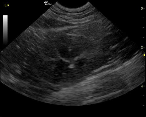 Interstitial Cystitis In A 6 Year Old Fs Dsh Cat Members
