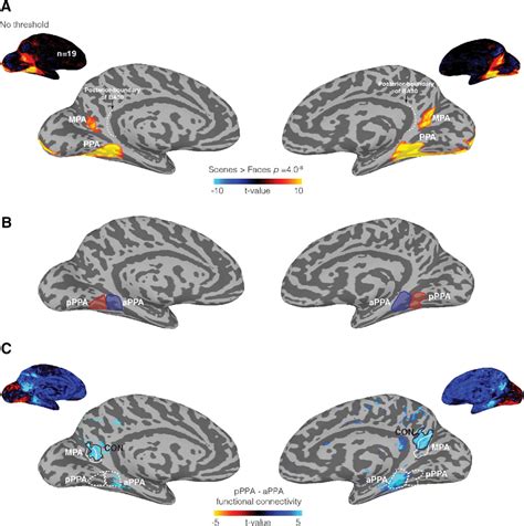 Functional Localization And Spatial Overlap Of Scene Selective And Download Scientific Diagram