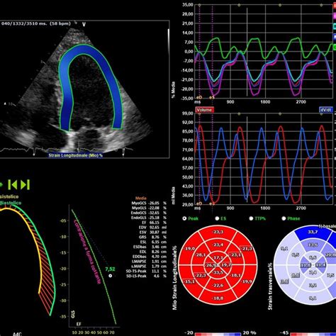 Representative Calculation Of Hemodynamic Force Parameters Obtained By