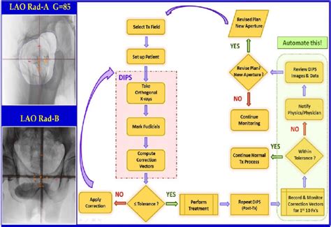 Schematic Diagram Of The Igrt Process Post Treatment Dips Are Taken To