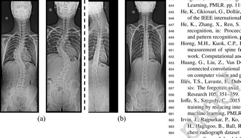 Best And Worst Cases In The Testing Dataset A The Worst 2 Images