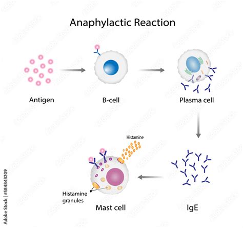 Stockvektorbilden Anaphylactic Reaction Allergic Reaction Autoimmune Disorders Allergy And