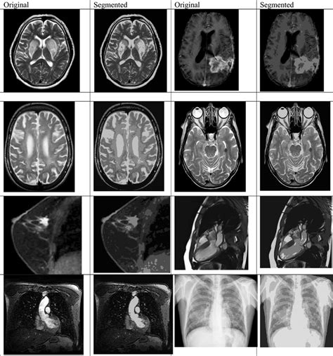 Experiment Results Of Segmented Images With Pit2fcm Download