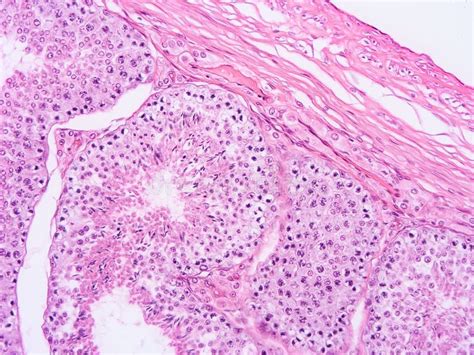 Human Testis Histology
