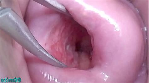 Japanese Wife Open Cervix Wide To Watch Inside Uterus Xxx Mobile Porno Videos Movies
