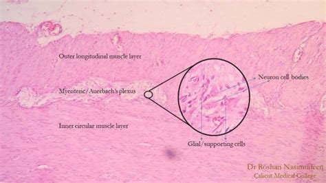 Difference Between Meissners And Auerbachs Plexus Compare The Difference Between Similar Terms