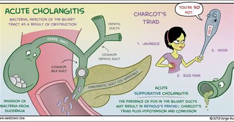 Cholangitis Triad