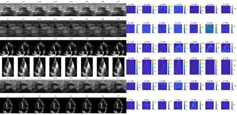 Despeckling Results After Necessary Parameter Tuning To Avoid Artifact Download Scientific