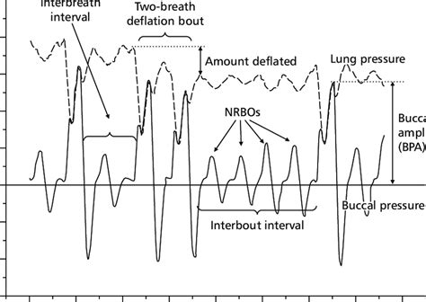 Sample Trace Illustrating The Parameters Extracted From The Toads