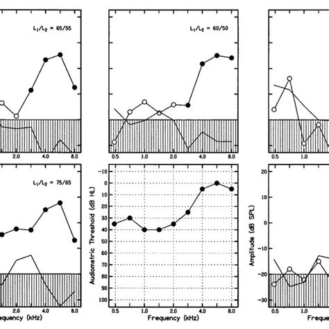 Audiogram And Dpgrams Constructed From The Io Functions Of Fig 4