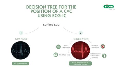Picc Placement In Patients With Atrial Fibrillation Campus Vygon Global