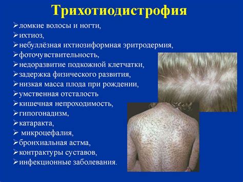 Генные болезни человека связанные с нарушением систем репарации презентация онлайн