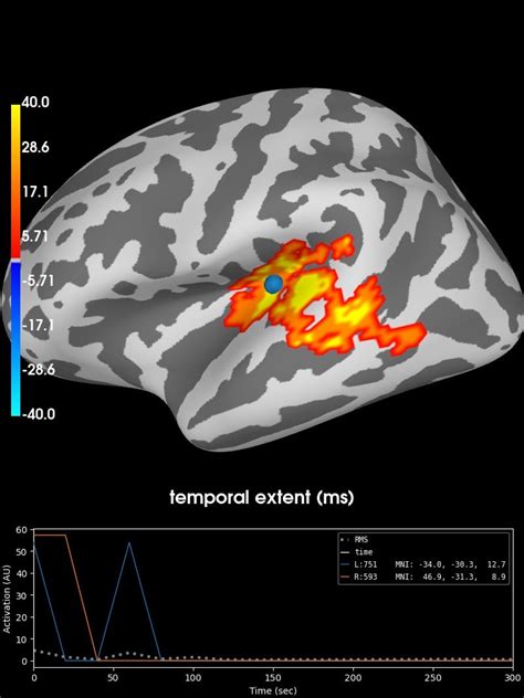 py mne eeg and ecg data learnpython