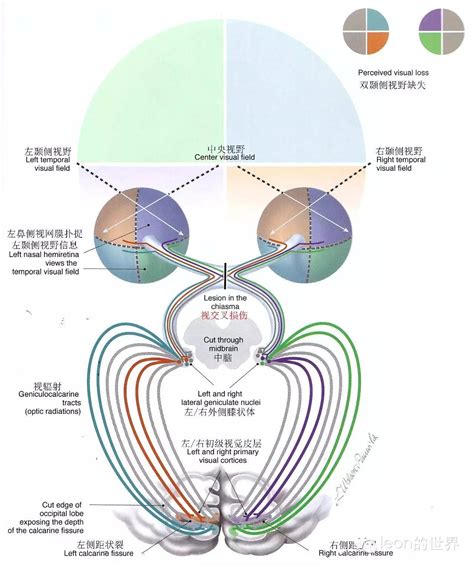 视觉传导通路 脑医汇