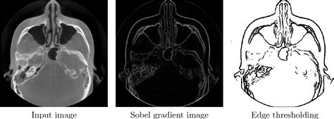 figure 2 1 from medical image segmentation using gpu accelerated